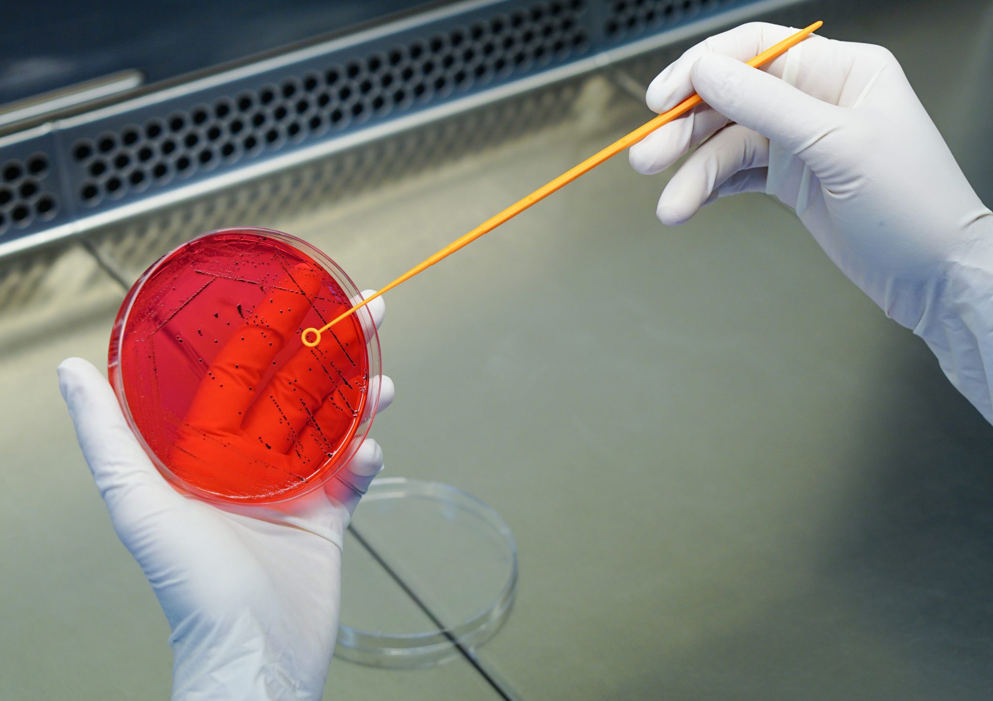 Fact sheet: Foodborne Illnesses in the Fresh Produce Sector - AUSVEG